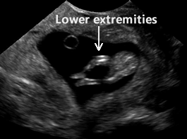 Ultrasound in the First Trimester (All Topics) and Components of Fetal ...